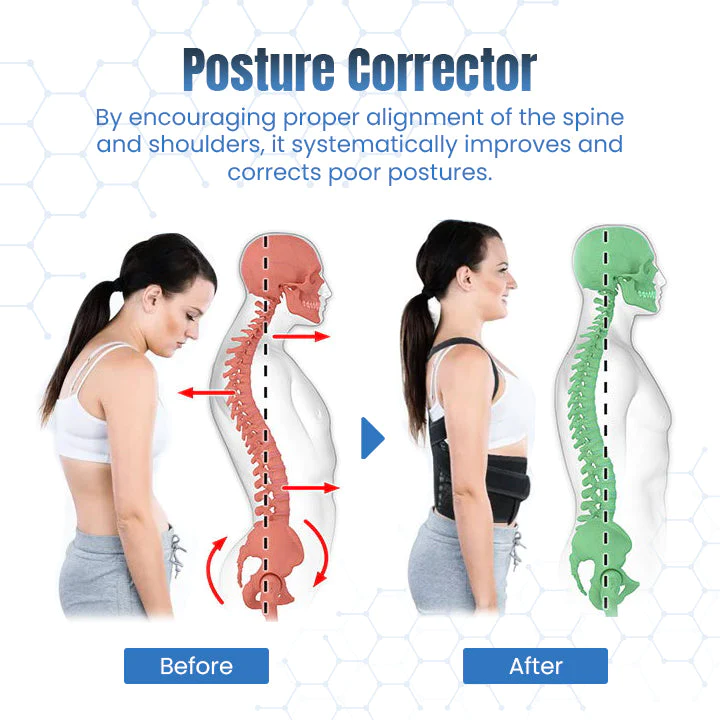Ceoerty™ AlignPRO Graphene Posture Corrector - MOONQO